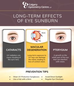 Can You Sunburn Your Eyes?